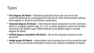 Conduction abnormalities part 2 | PPTX