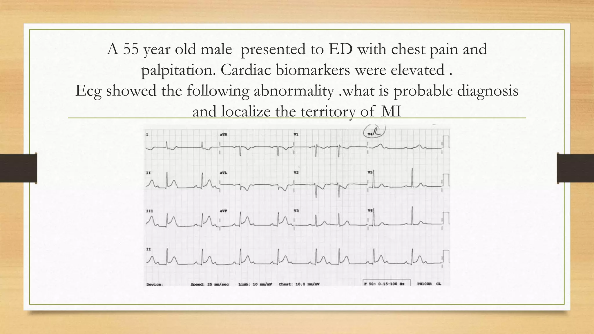 Conduction abnormalities part 2 | PPT | Free Download