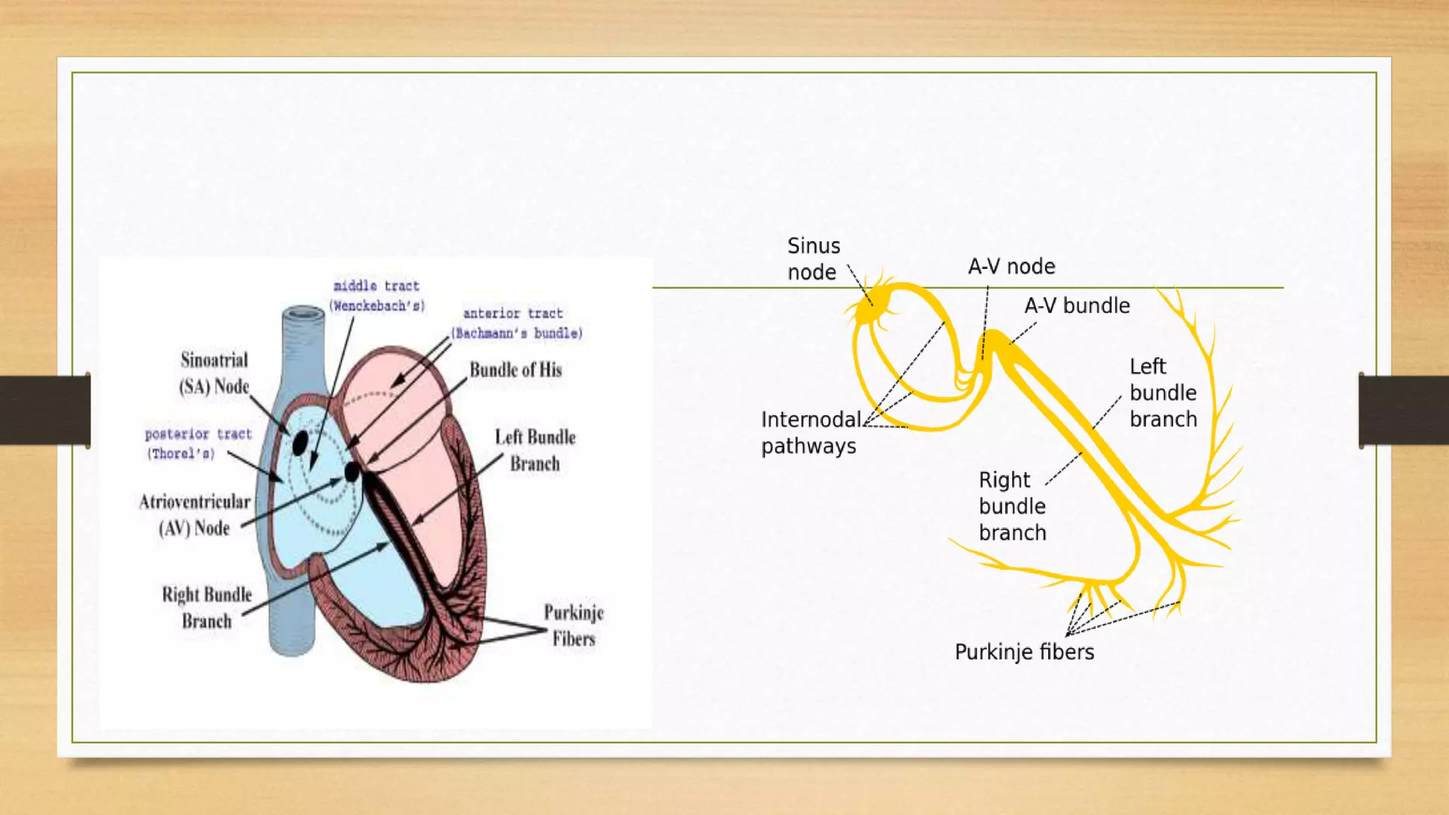 Conduction abnormalities part 2 | PPTX