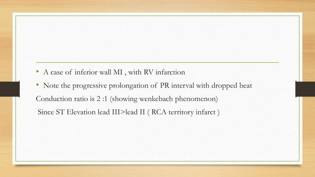 Conduction abnormalities part 2 | PPTX