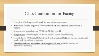 Conduction abnormalities part 2 | PPTX
