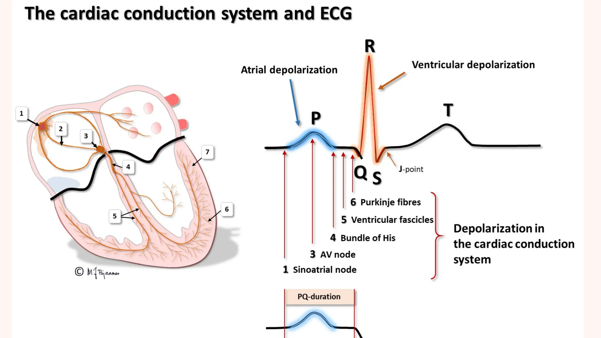 Conduction and its abnormalities .pdf