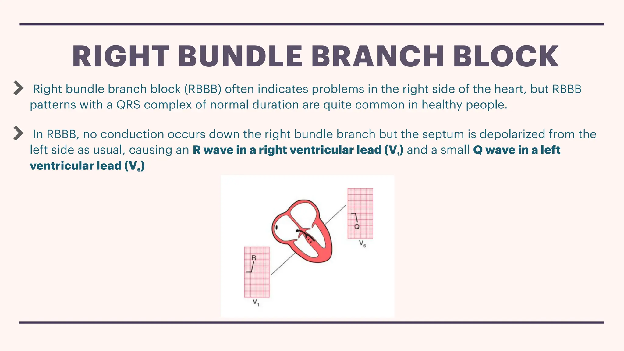 Conduction and its abnormalities .pdf