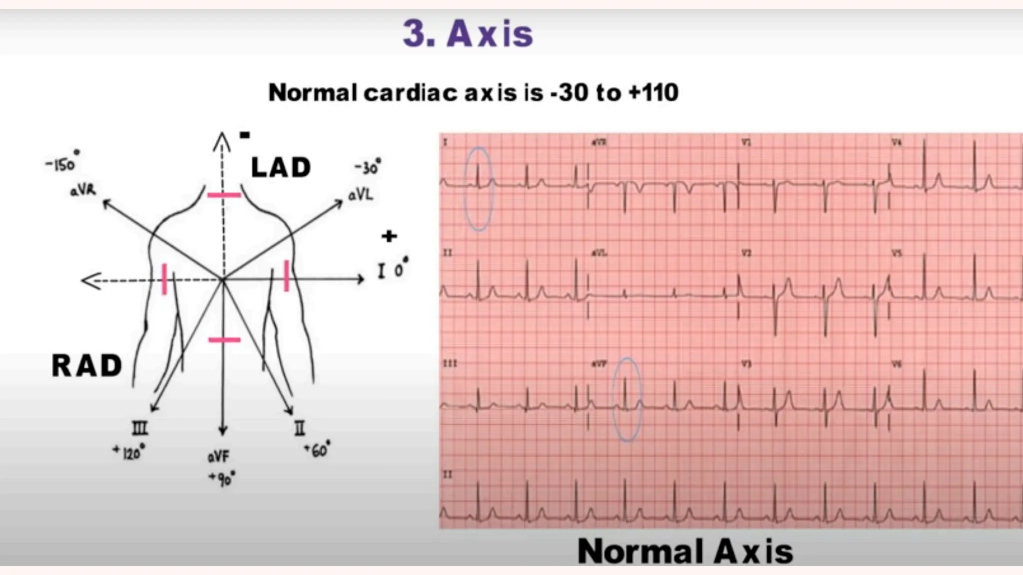 Conduction and its abnormalities .pdf