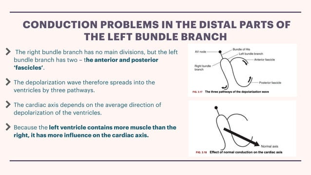 Conduction and its abnormalities .pdf