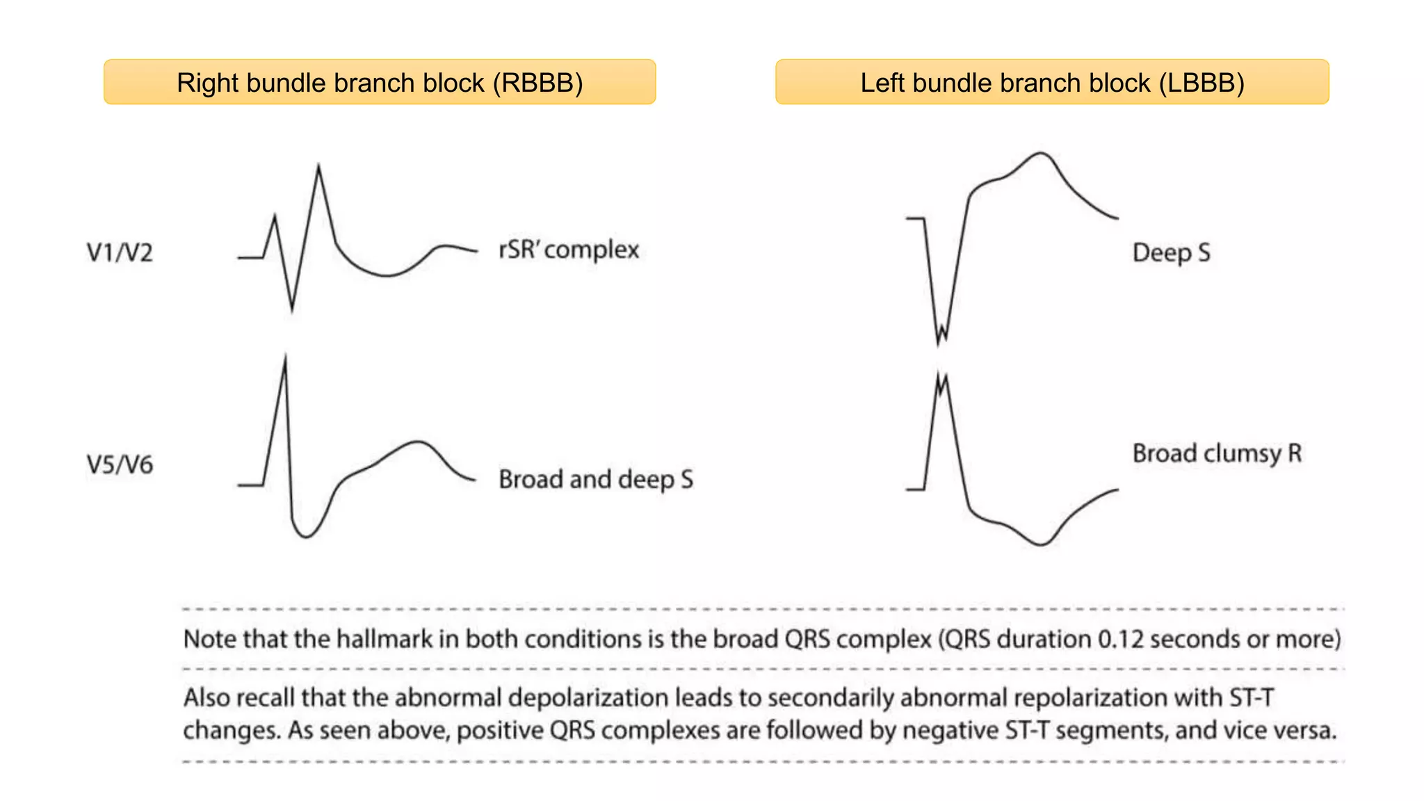 ECG - Conduction defects - Hoang Van Cuong HMU | PPT