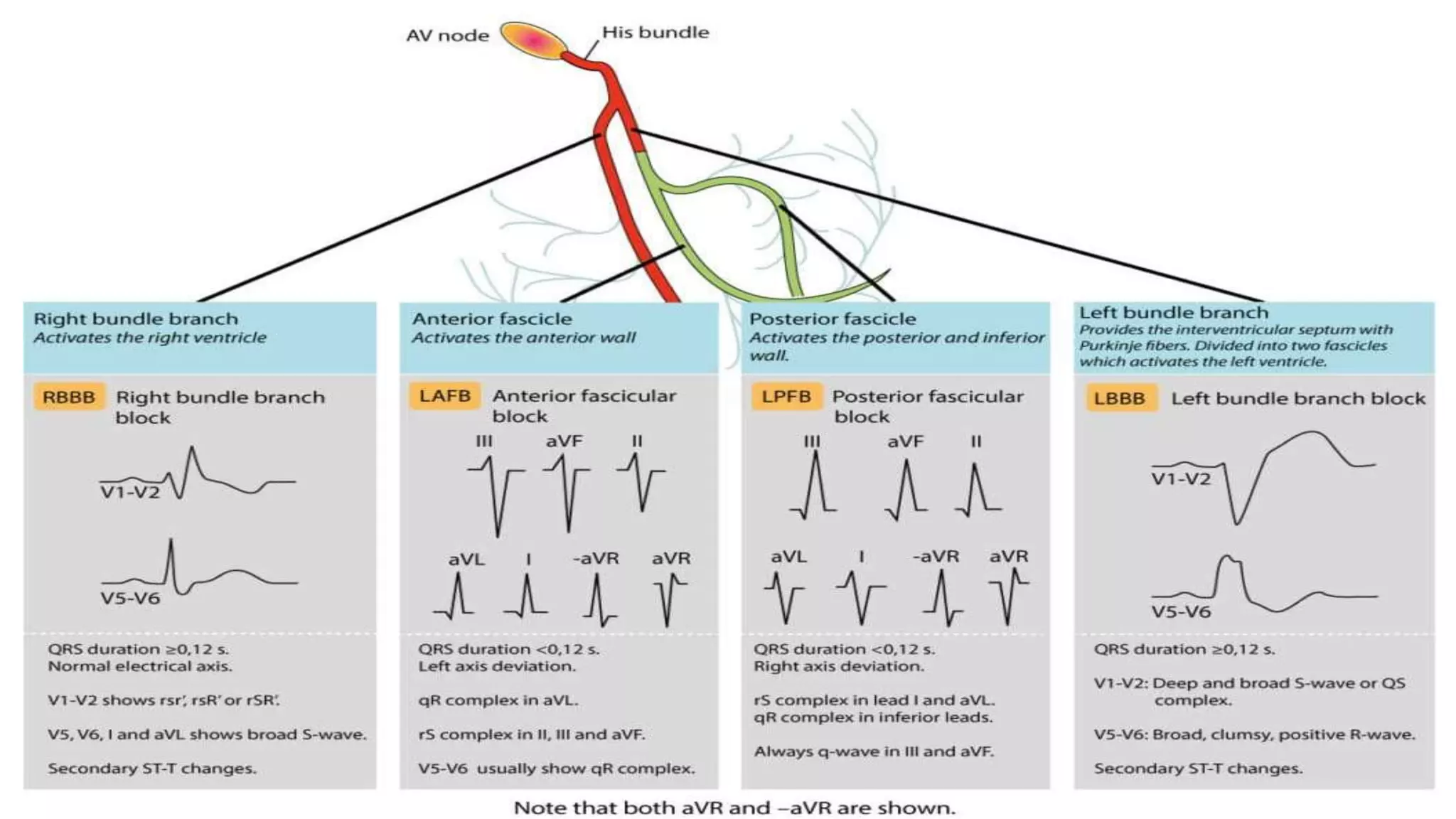 ECG - Conduction defects - Hoang Van Cuong HMU | PPT