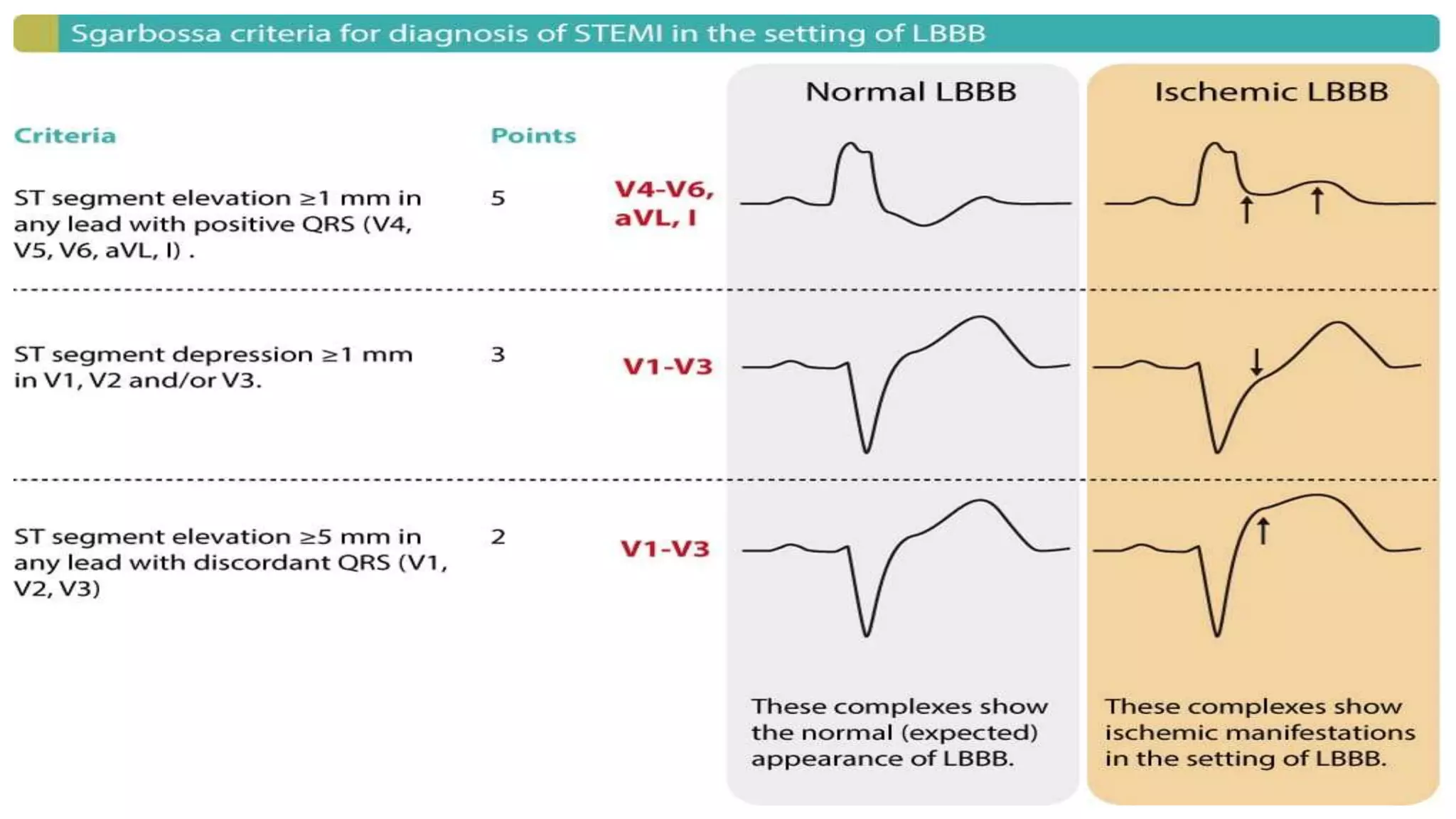 ECG - Conduction defects - Hoang Van Cuong HMU | PPT