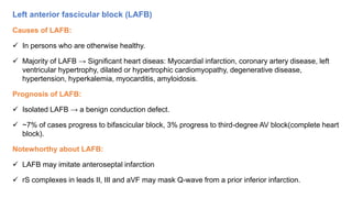 ECG - Conduction defects - Hoang Van Cuong HMU | PPTX