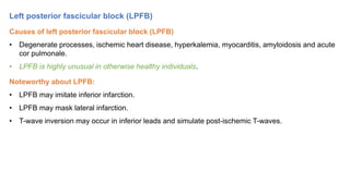 ECG - Conduction defects - Hoang Van Cuong HMU | PPTX