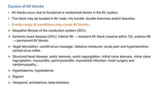 ECG - Conduction defects - Hoang Van Cuong HMU | PPT