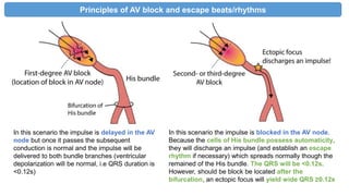 ECG - Conduction defects - Hoang Van Cuong HMU | PPT