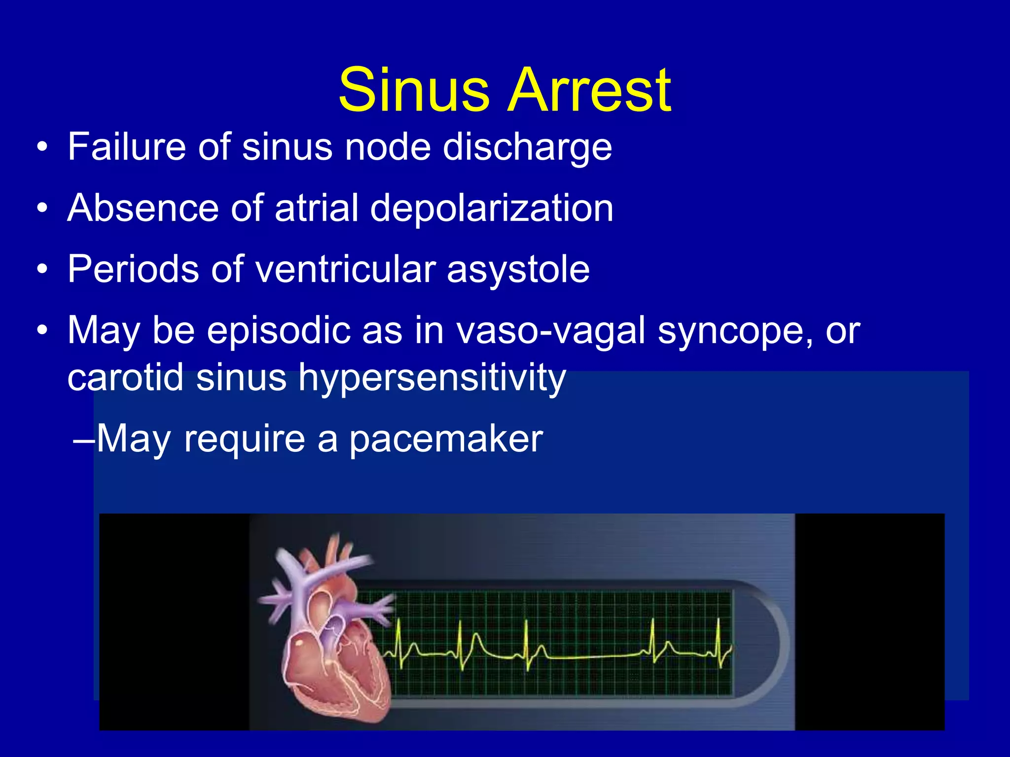 Conduction Disorders | PPTX