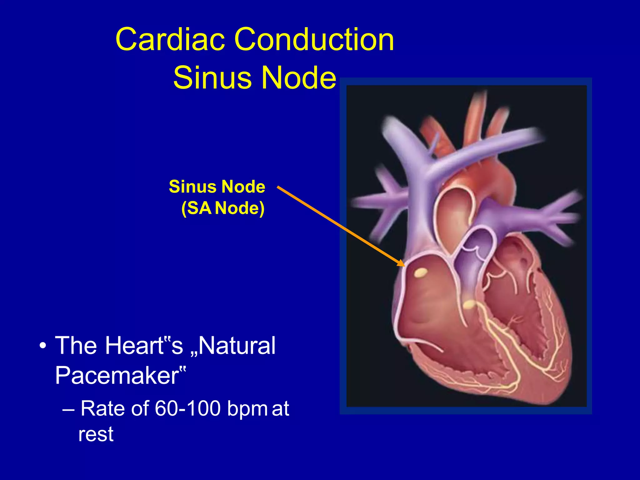 Conduction Disorders | PPTX