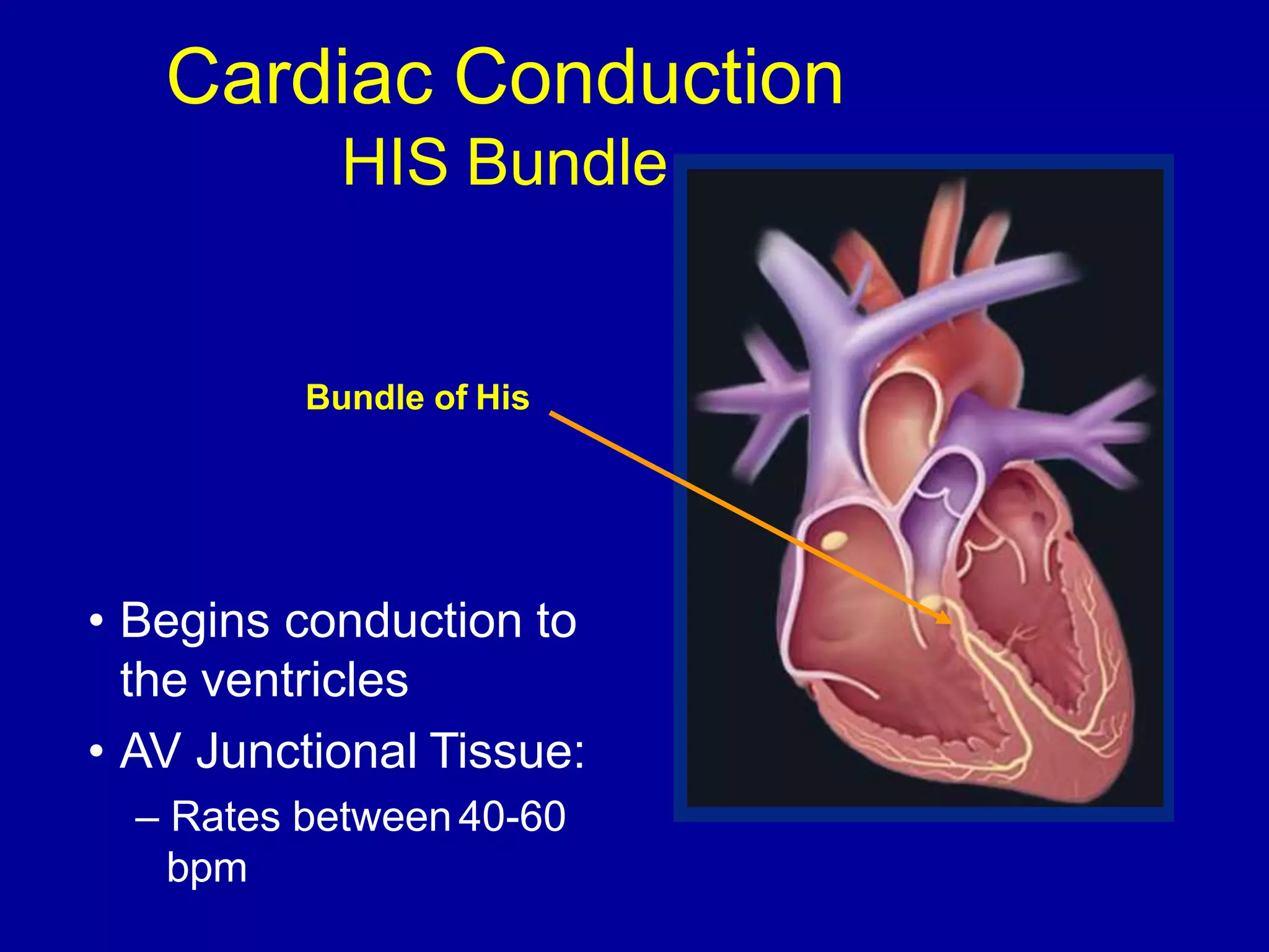 Conduction Disorders | PPTX