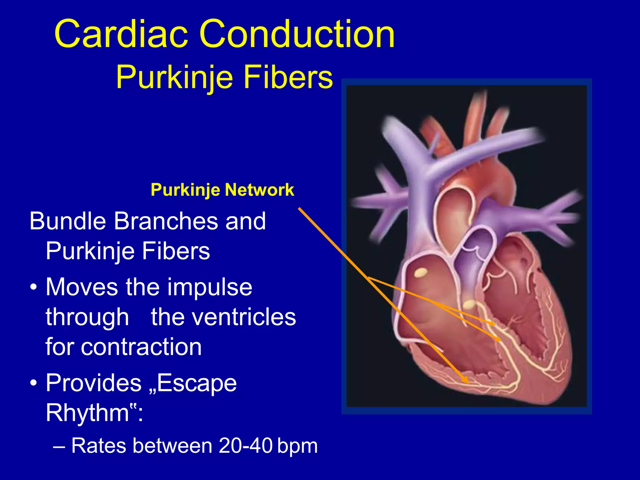 Conduction Disorders | PPTX