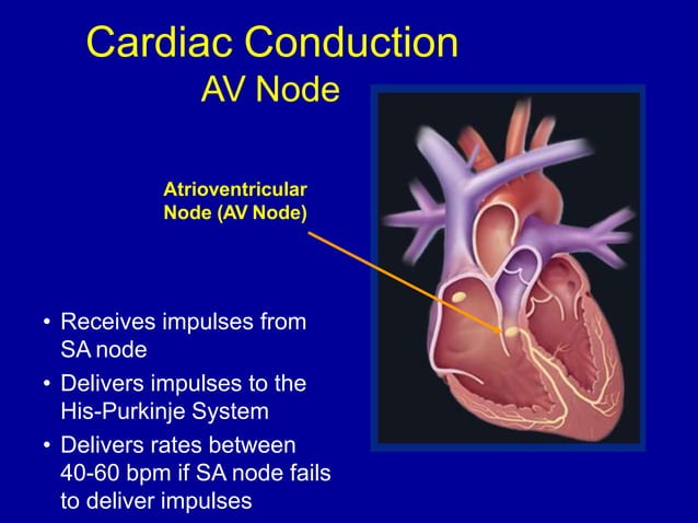 Conduction Disorders | PPTX | Heart and Cardiovascular Diseases ...