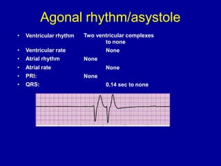 Agonal Rhythmasystole