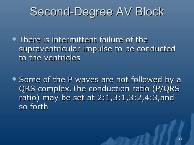 ECG, Conduction disturbances | PPT