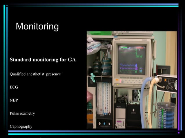 Conduction of general anesthesia | PPT