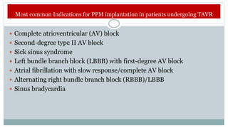Conduction system abnormalities after transcatheter aortic valve replacement mechanism ...