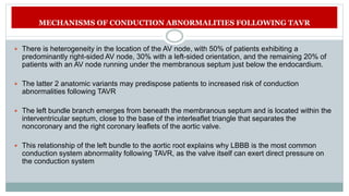 Conduction system abnormalities after transcatheter aortic valve replacement mechanism ...
