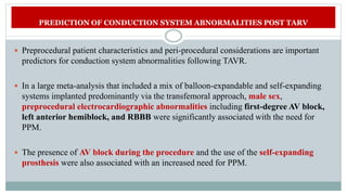 Conduction system abnormalities after transcatheter aortic valve replacement mechanism ...