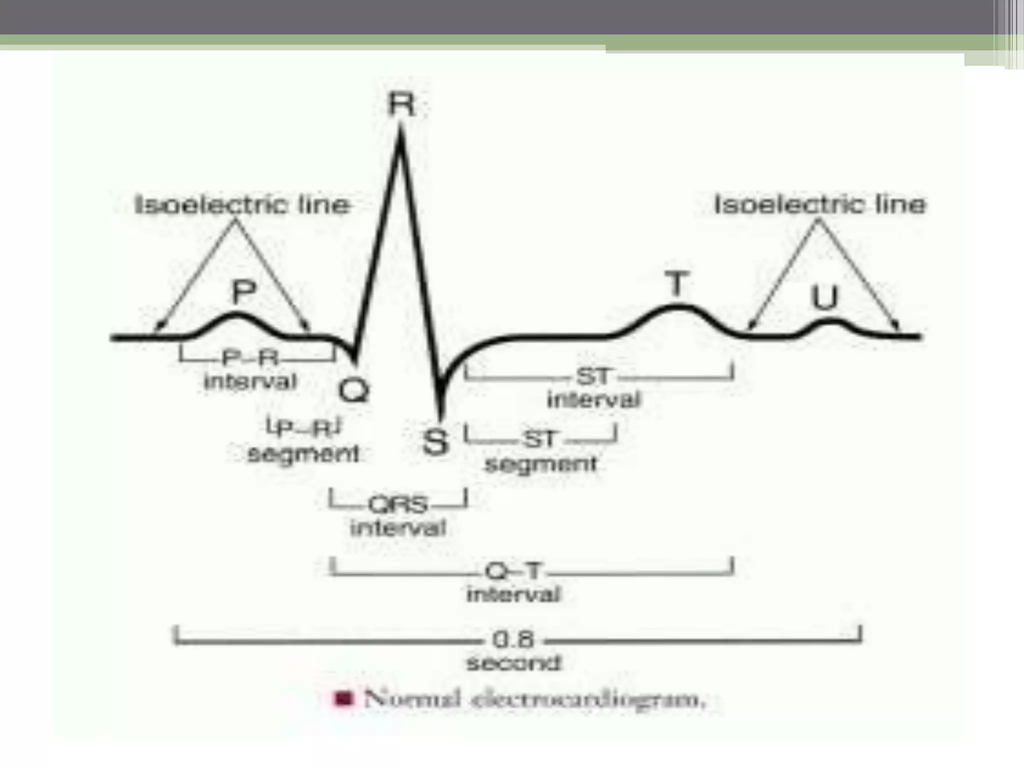 Conduction system and ecg | PPTX