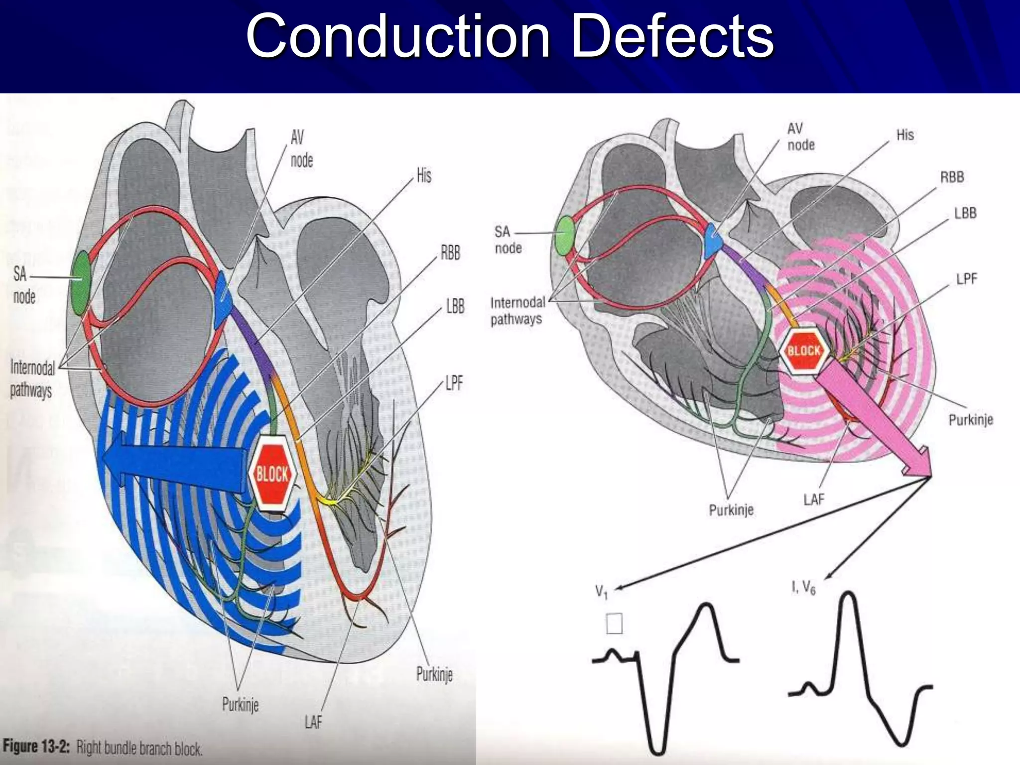 Conduction system of heart | PPTX