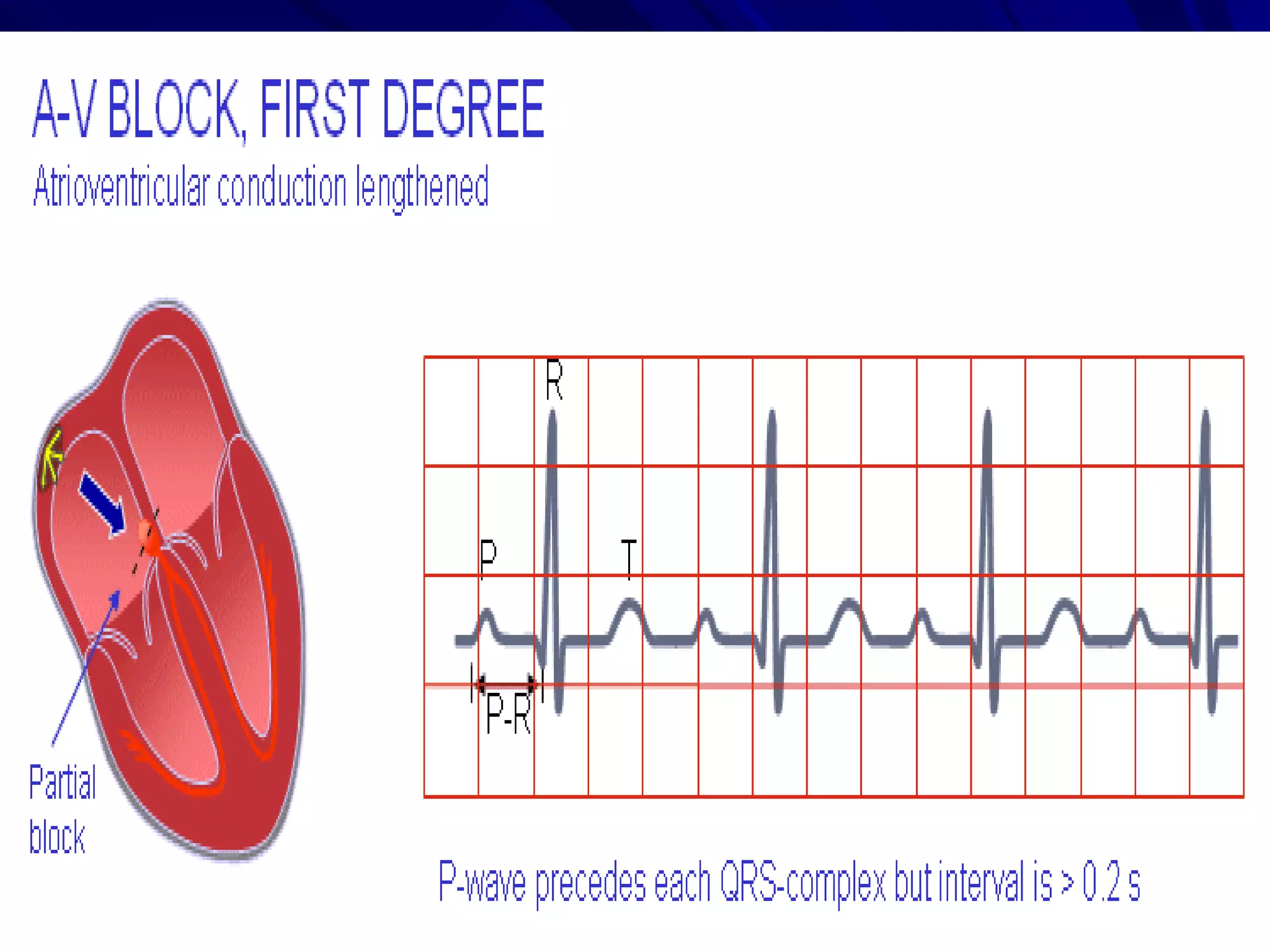 Conduction system of heart | PPTX