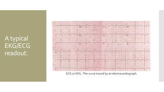 Conduction system of heart | PPTX