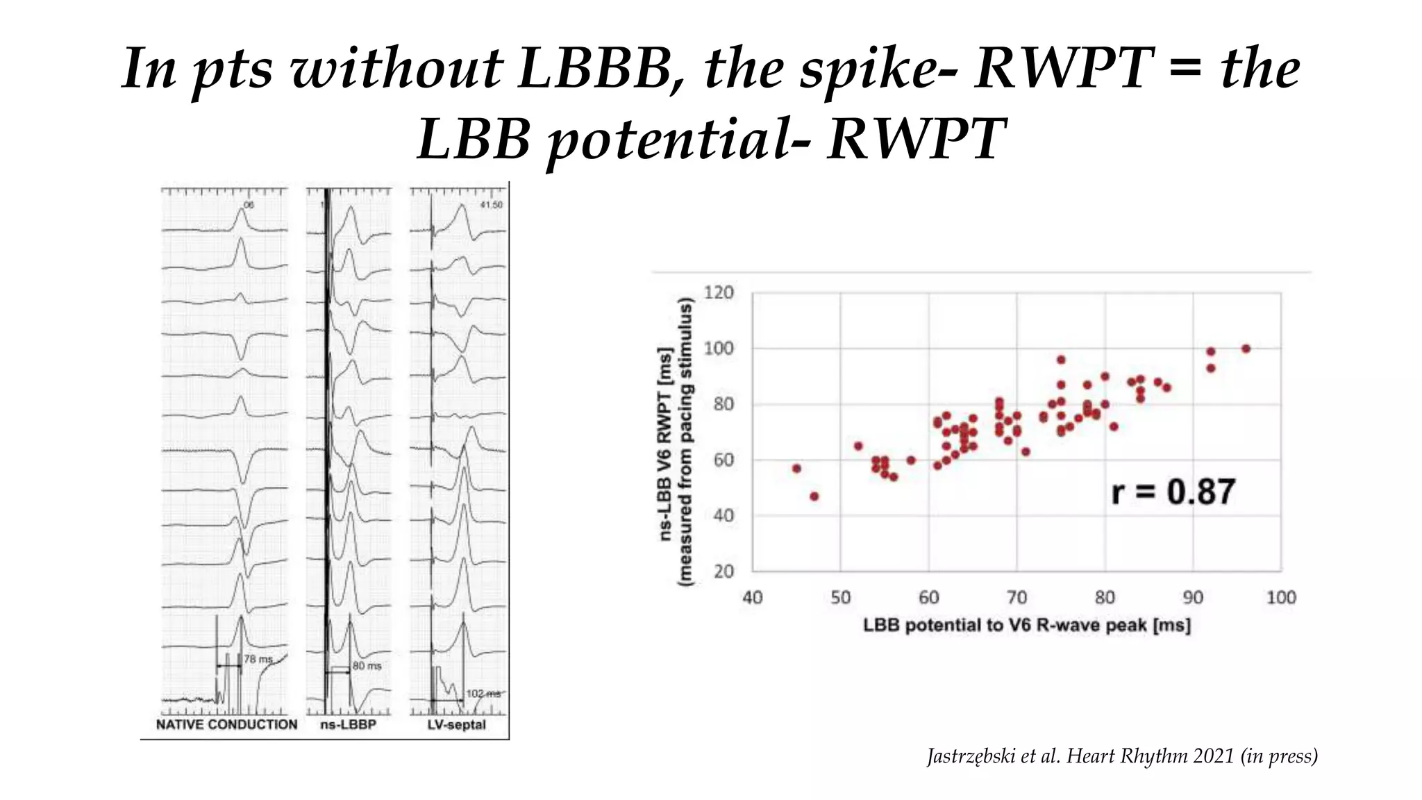 Conduction system pacing as resynchronization | PPTX