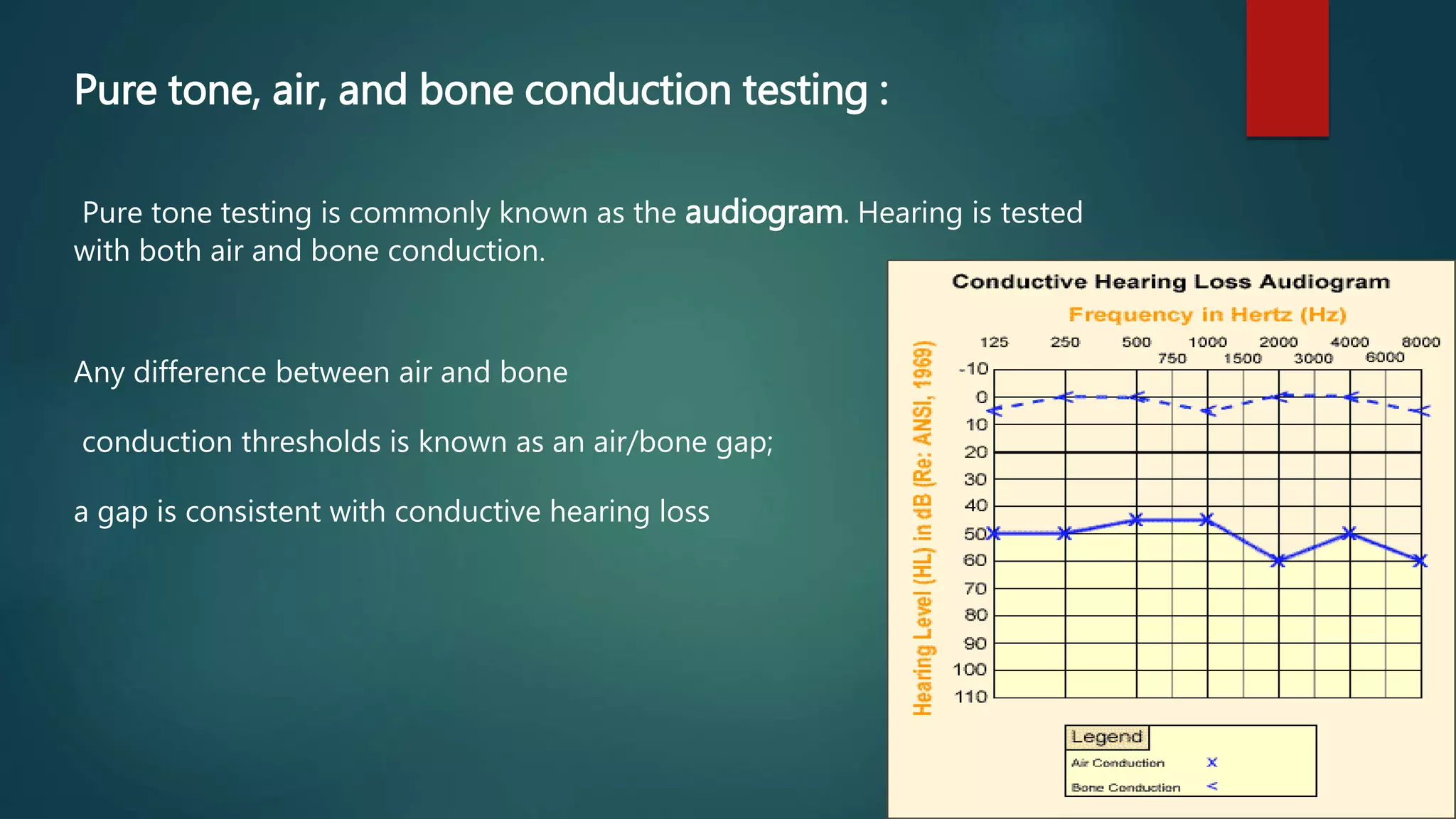 Conductive hearing loss | PPTX