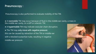 Conductive hearing loss | PPTX