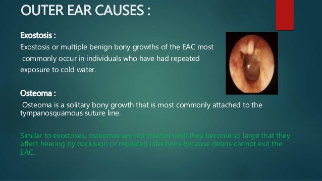 Conductive hearing loss