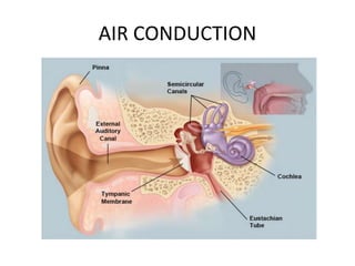 Conductive hearing loss | PPTX