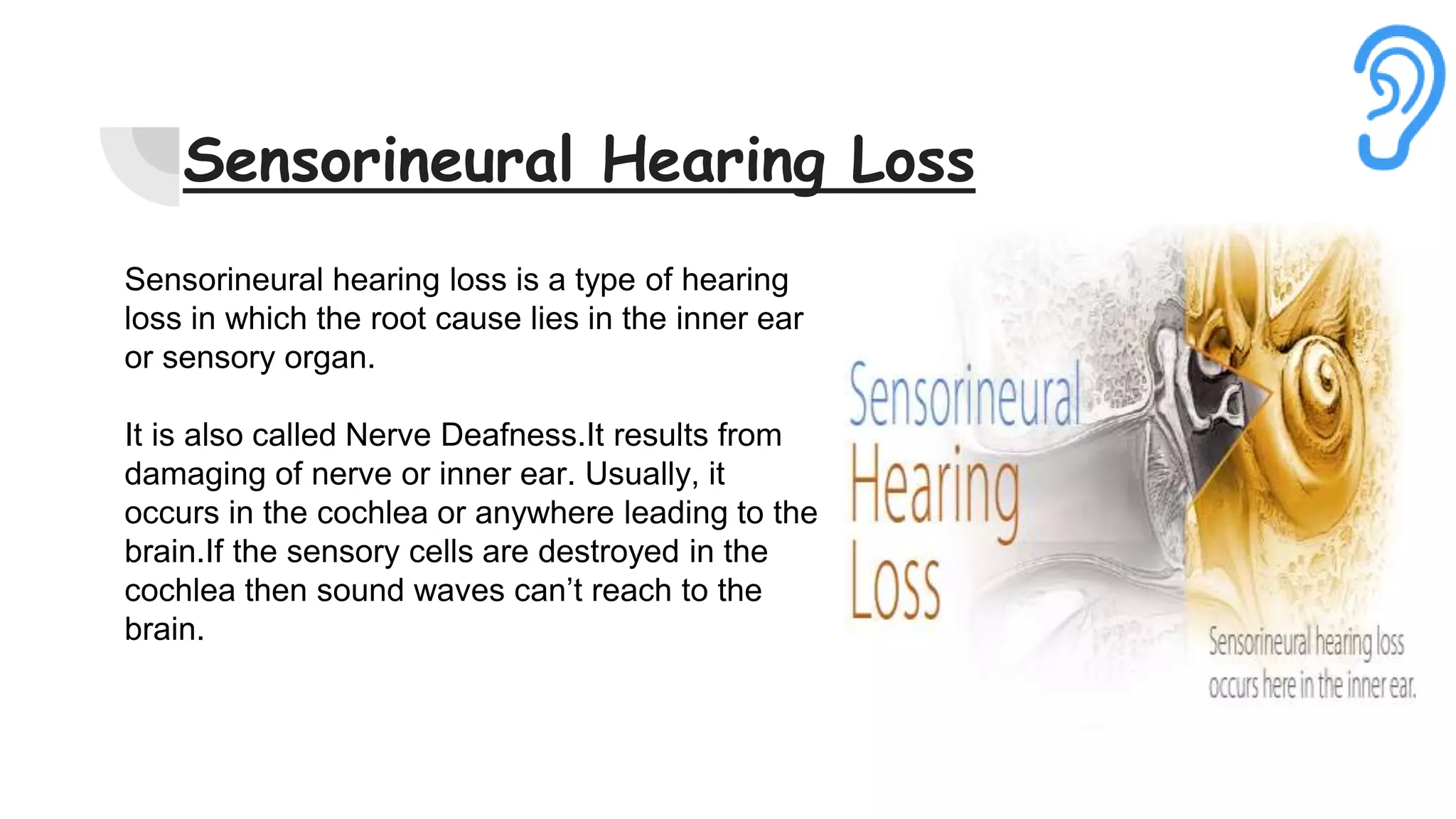 Conductive vs sensorineural hearing loss | PPTX | Digital Audio ...
