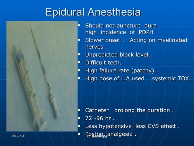 Conduct Of Local Anesthesia Technique And Complication | PPT
