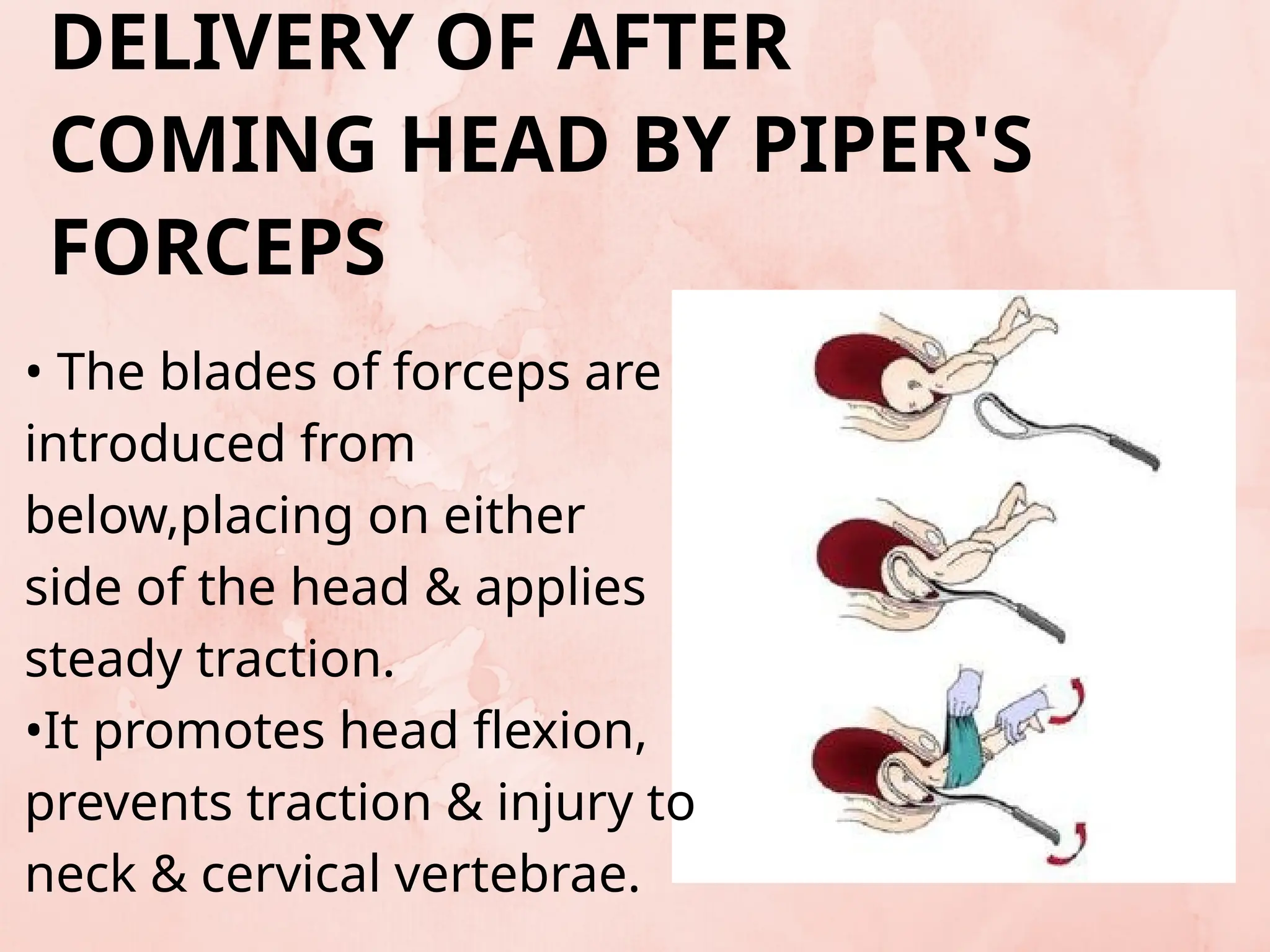 Conduct of vaginal delivery _20251004_170613_0000.pptx