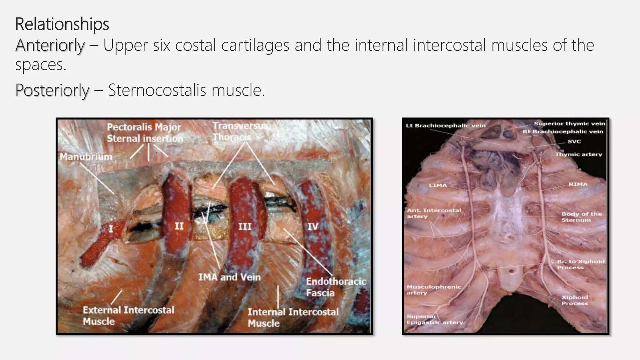 Conduits used in CABG. | PPTX
