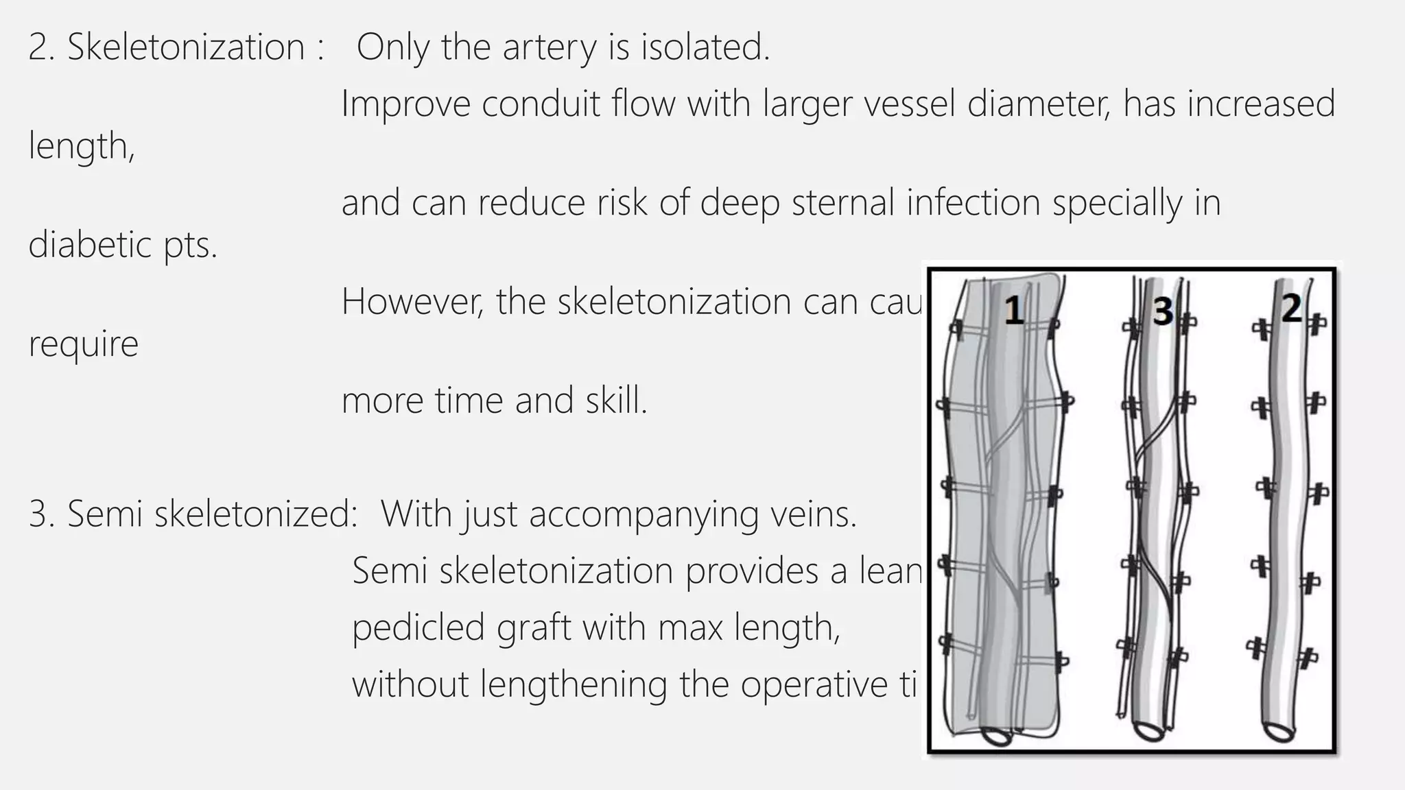 Conduits used in CABG. | PPTX