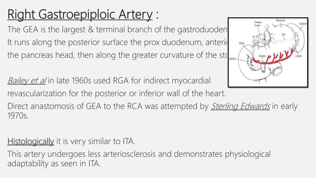 Conduits used in CABG. | PPTX