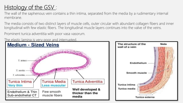 Conduits used in CABG. | PPTX