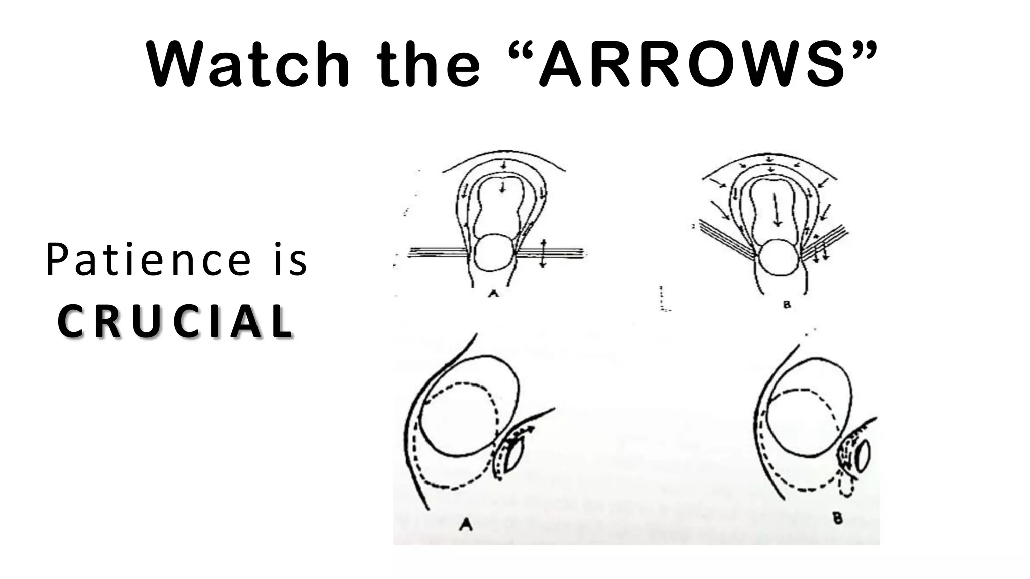 Conduct of vaginal delivery | PPTX