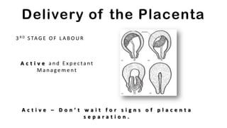 Conduct of vaginal delivery | PPTX