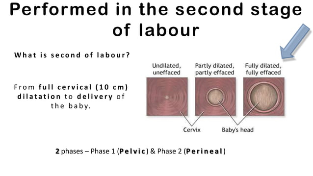 Conduct of vaginal delivery | PPTX