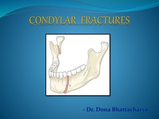Condylar Process