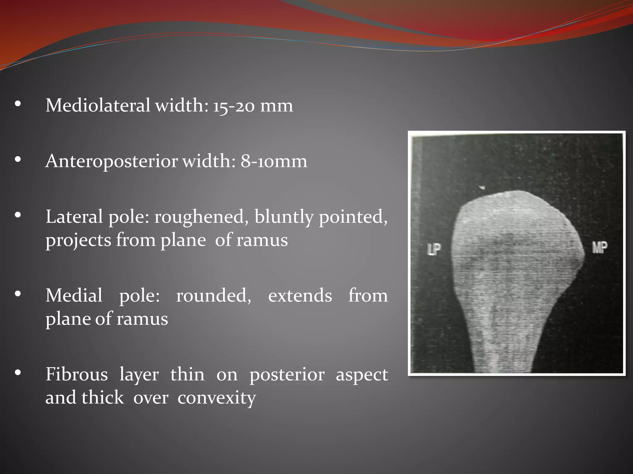 Condylar # | PPTX