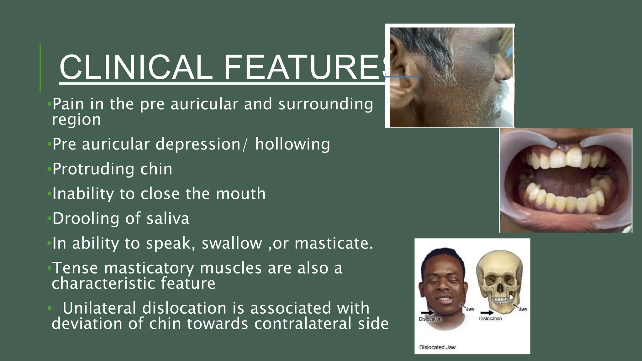 condylar dislocation- etiopathogenesis & treatment | PPTX