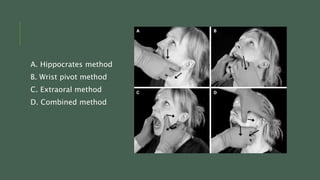 condylar dislocation- etiopathogenesis & treatment | PPTX
